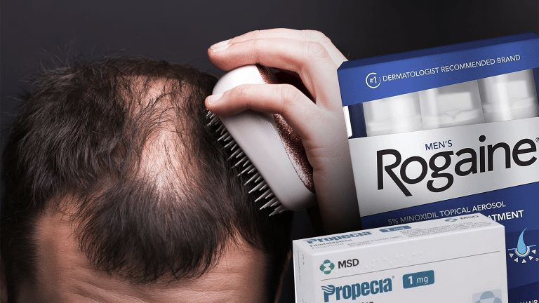 הכל על מינוקסי (מינוקסידיל) - המושתלים